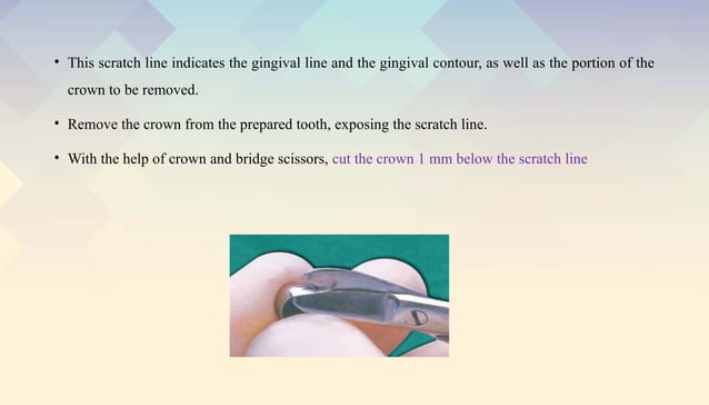 stainless steel crowns in pediatric dentistry | PPTX | Dental Health ...