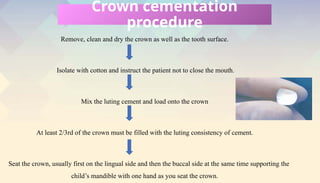 stainless steel crowns in pediatric dentistry | PPTX