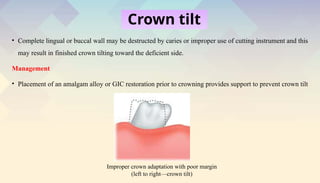 stainless steel crowns in pediatric dentistry | PPTX