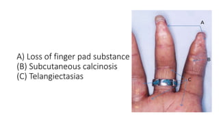 Systemic Sclerosis | PPTX