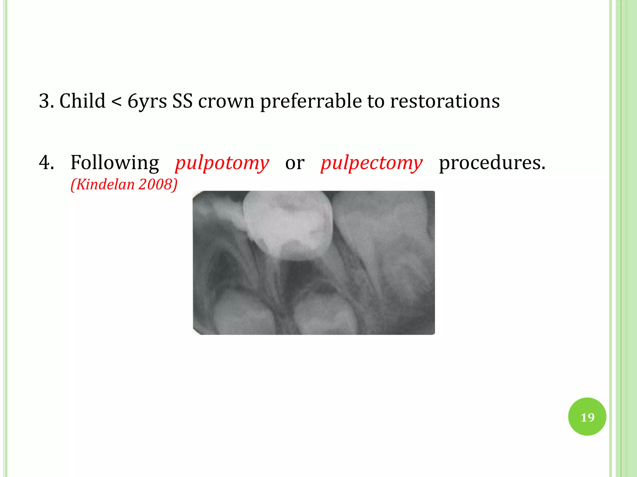 Stainless steel crowns in Pediatric Dentistry | PPTX | Oral care ...