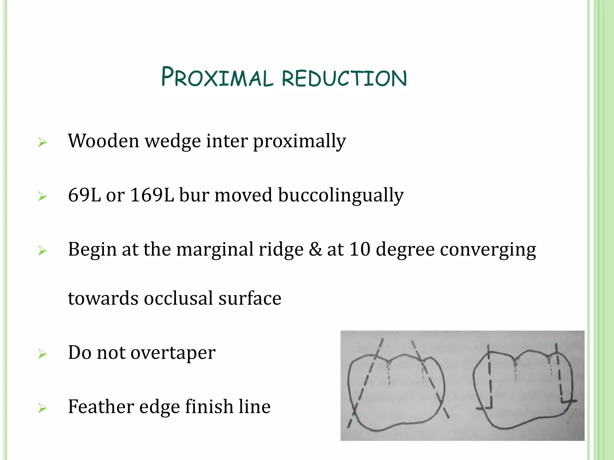 Stainless steel crowns in Pediatric Dentistry | PPTX