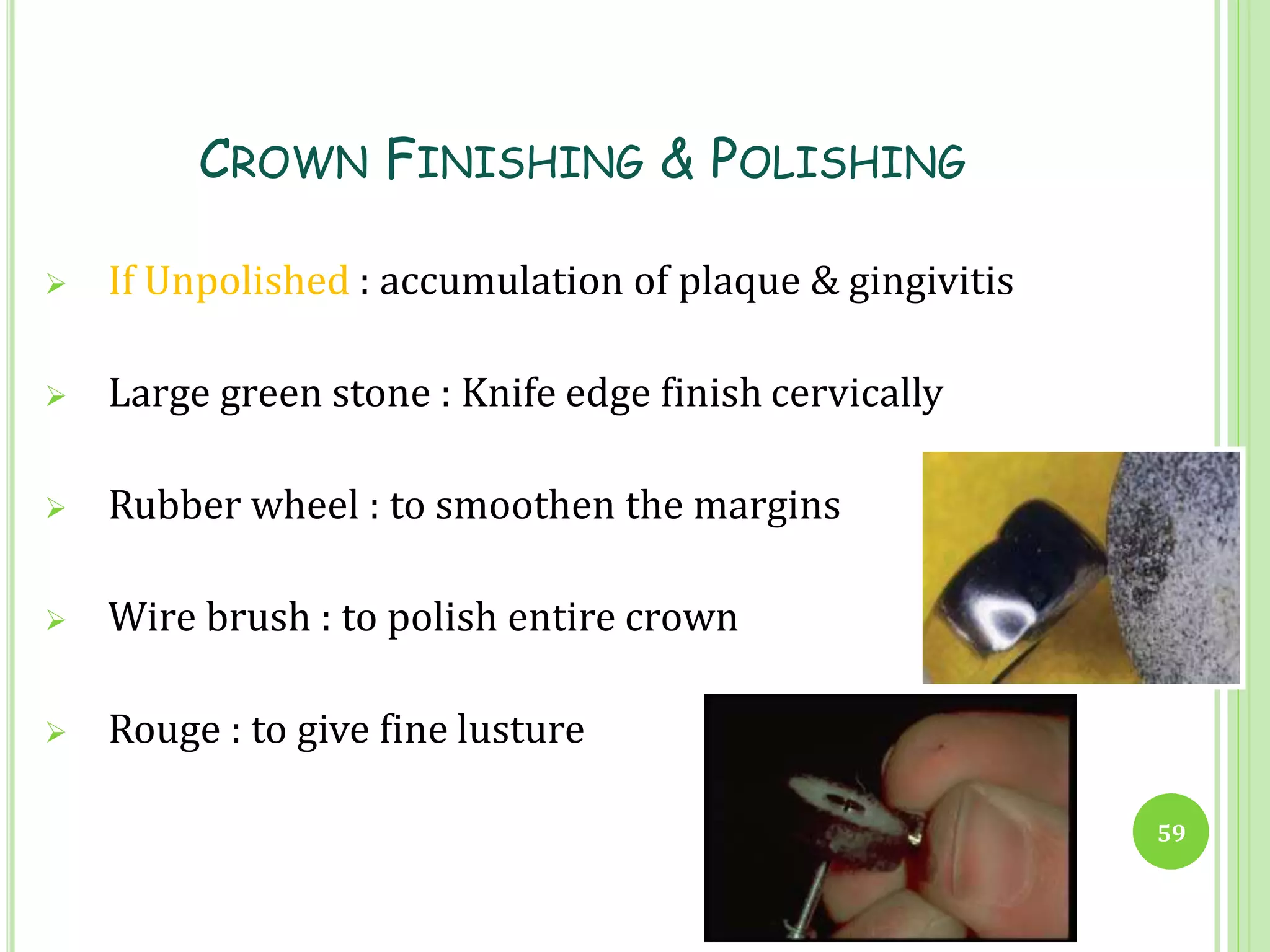 Stainless steel crowns in Pediatric Dentistry | PPTX