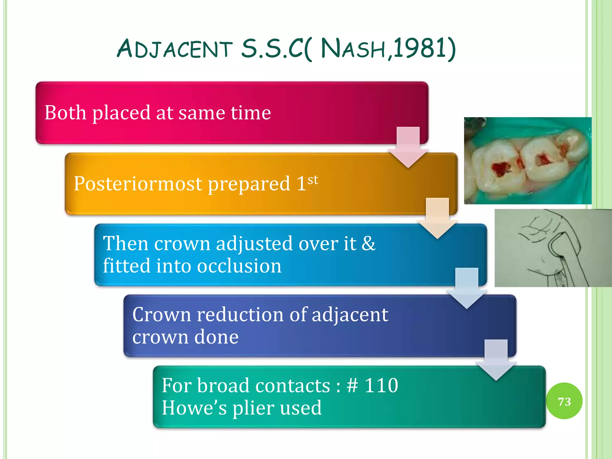 Stainless steel crowns in Pediatric Dentistry | PPTX