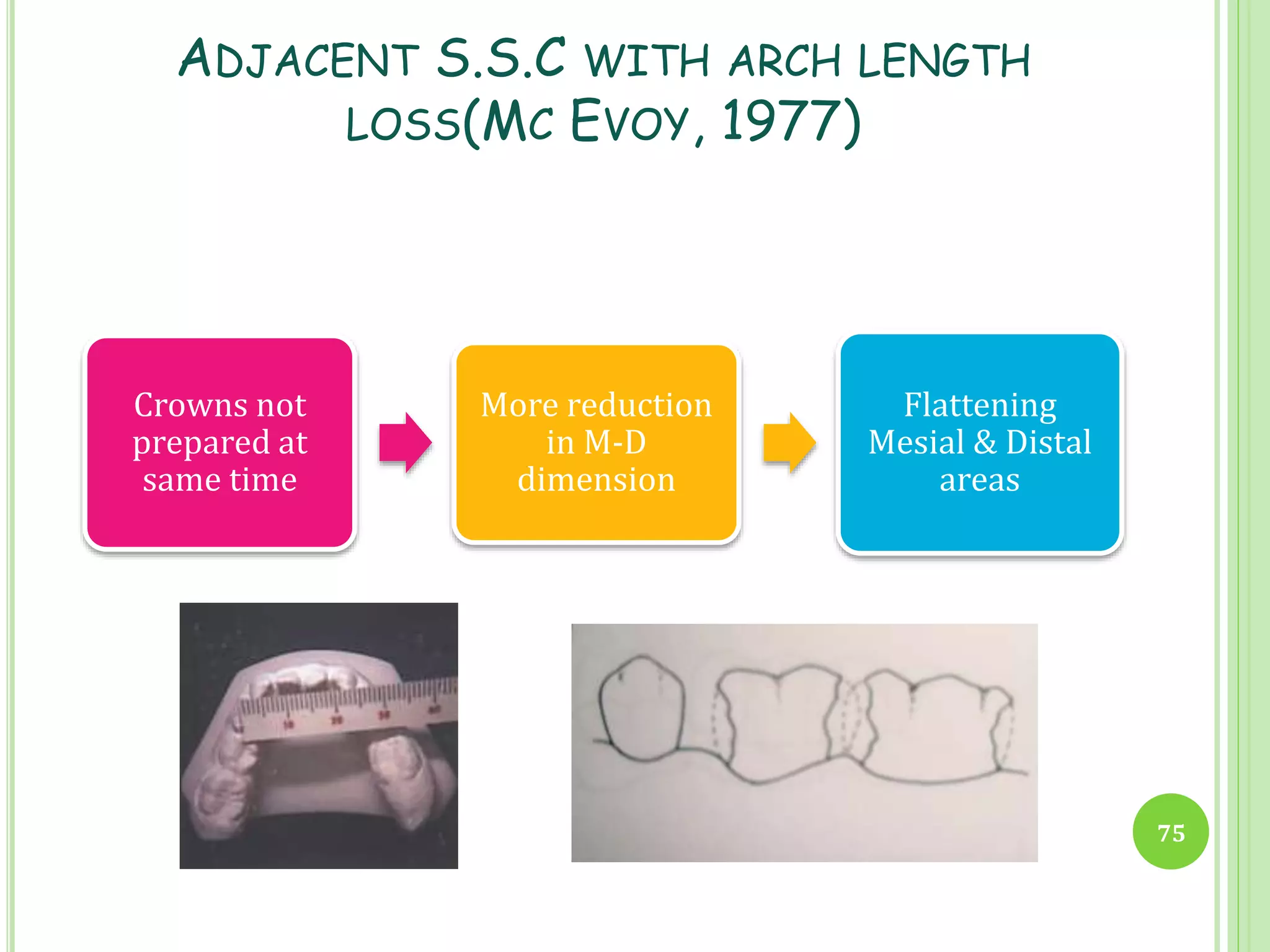 Stainless steel crowns in Pediatric Dentistry | PPTX
