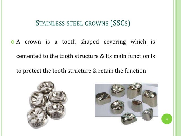 Stainless steel crowns in Pediatric Dentistry | PPTX | Oral care ...