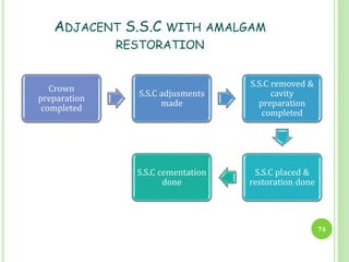 Stainless steel crowns in Pediatric Dentistry | PPTX