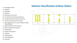Management of Bone Defects | PPTX