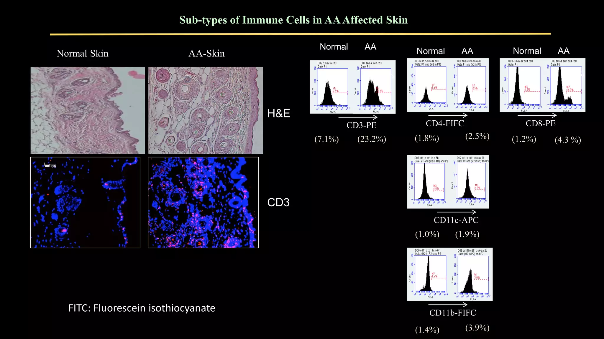 SSEA-Positive Myeloid Cells are Involved in Hair Loss in the Alopecia ...