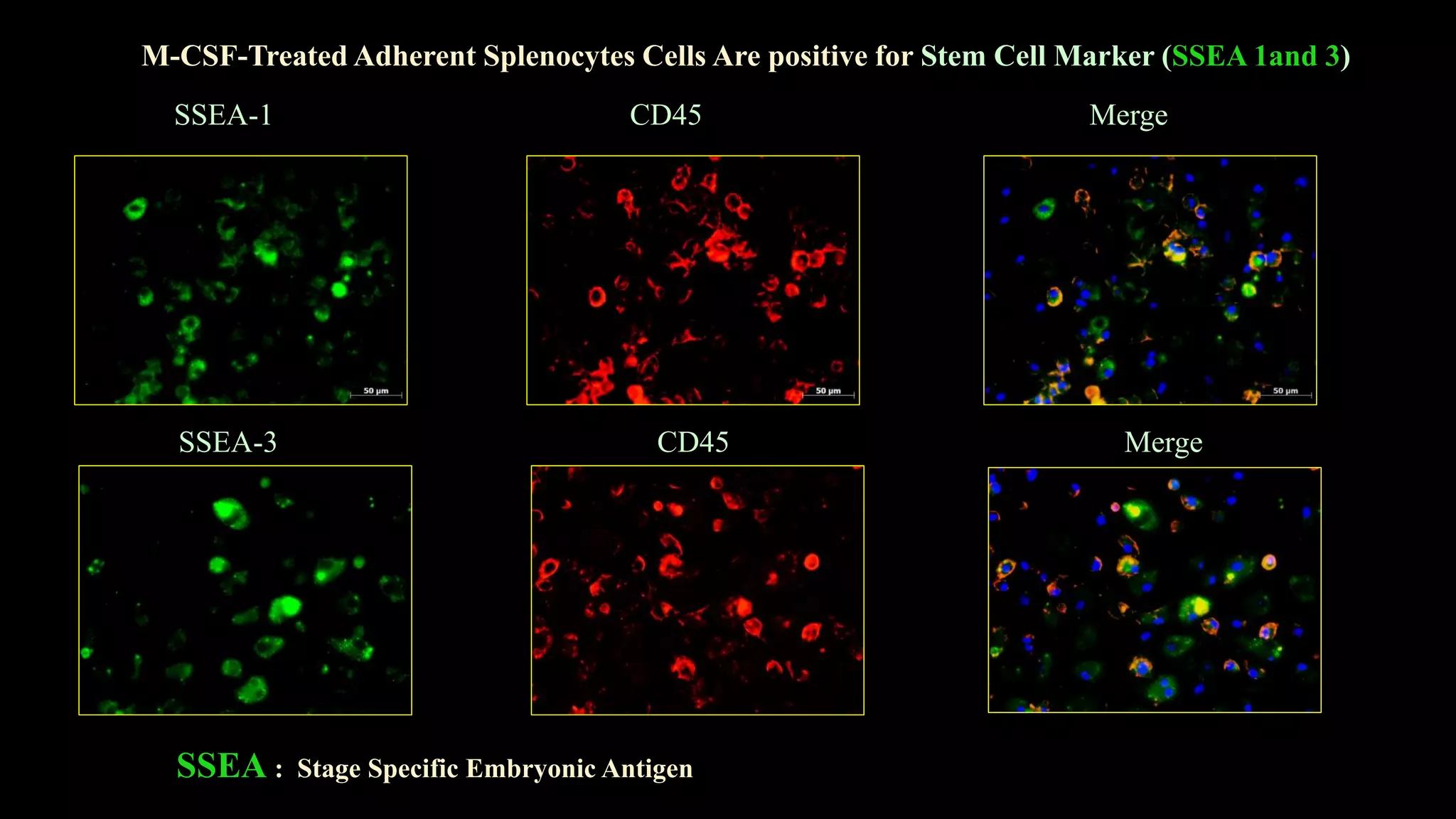 SSEA-Positive Myeloid Cells are Involved in Hair Loss in the Alopecia ...