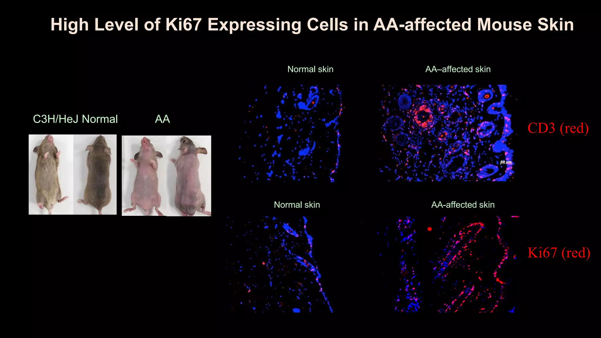 SSEA-Positive Myeloid Cells are Involved in Hair Loss in the Alopecia ...