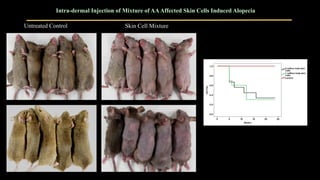 SSEA-Positive Myeloid Cells are Involved in Hair Loss in the Alopecia ...