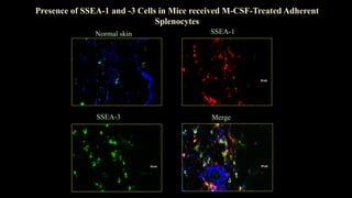 SSEA-Positive Myeloid Cells are Involved in Hair Loss in the Alopecia ...