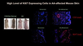 SSEA-Positive Myeloid Cells are Involved in Hair Loss in the Alopecia ...