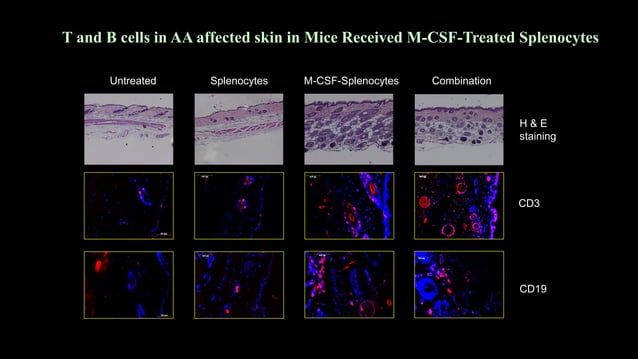 SSEA-Positive Myeloid Cells are Involved in Hair Loss in the Alopecia ...