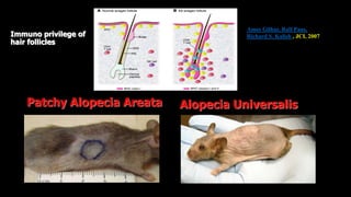 SSEA-Positive Myeloid Cells are Involved in Hair Loss in the Alopecia ...