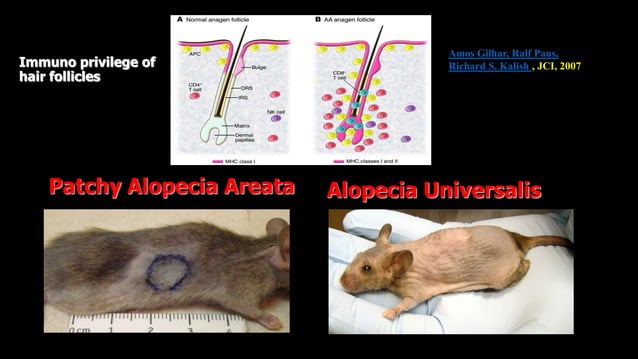 SSEA-Positive Myeloid Cells are Involved in Hair Loss in the Alopecia ...