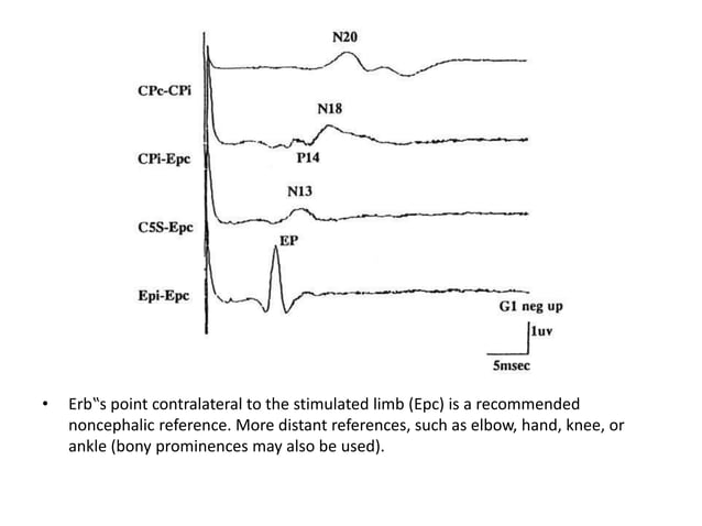 Somato Sensory Evoked Potentials (SSEP) By: Murtaza Syed | PPTX