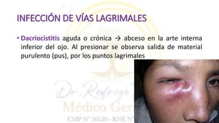 SEMIOLOGIA DE LA CABEZA | PPTX