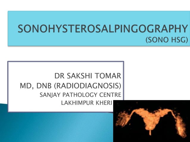 SONOSALPINGOGRAPHY STEPS BY LATE DR SAKSHI | PPT