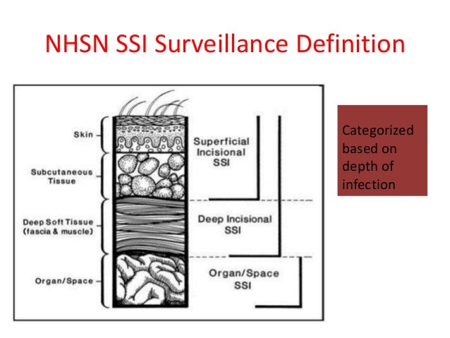 SURGICAL SITE INFECTIONS
