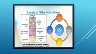 SSI SURGICAL SITE INFECTION | PPT