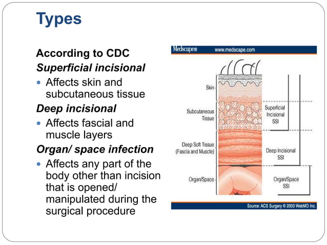Surgical Site Infections | PPTX