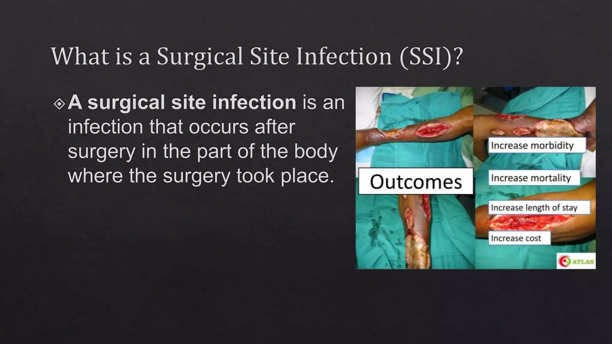 surgical site infection | PPTX