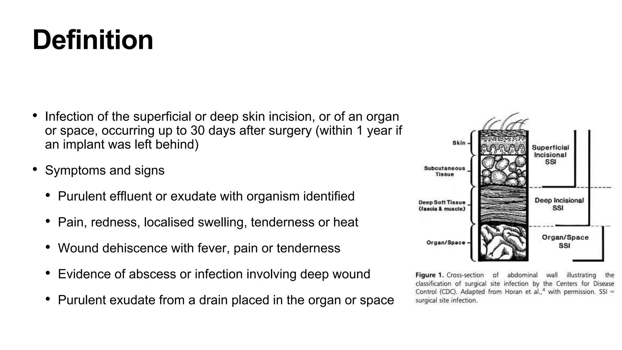 Surgical Site Infection (Obstetrics and Gynaecology) | PPTX