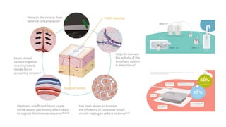 Surgical Site Infection (Obstetrics and Gynaecology) | PPTX
