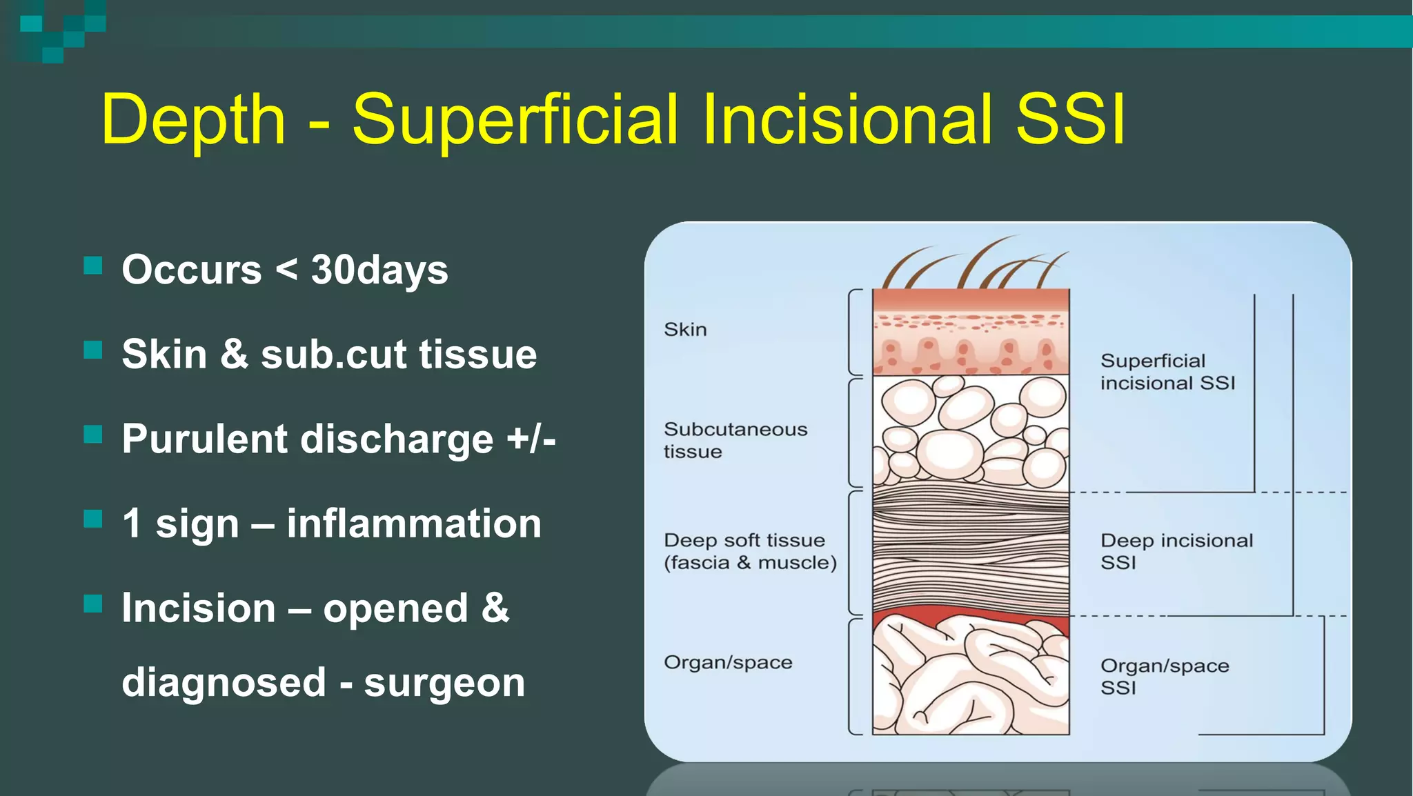 Surgical Site Infection | PPT