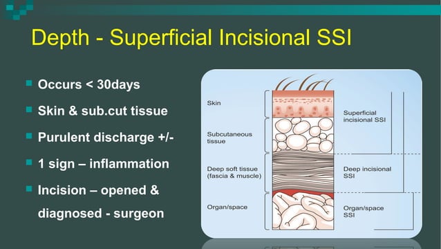 Surgical Site Infection | PPT