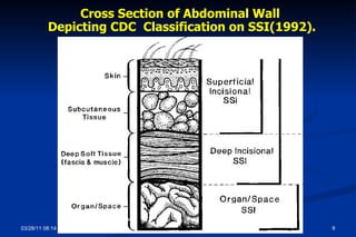 Ssi ;problems&prevention | PPT