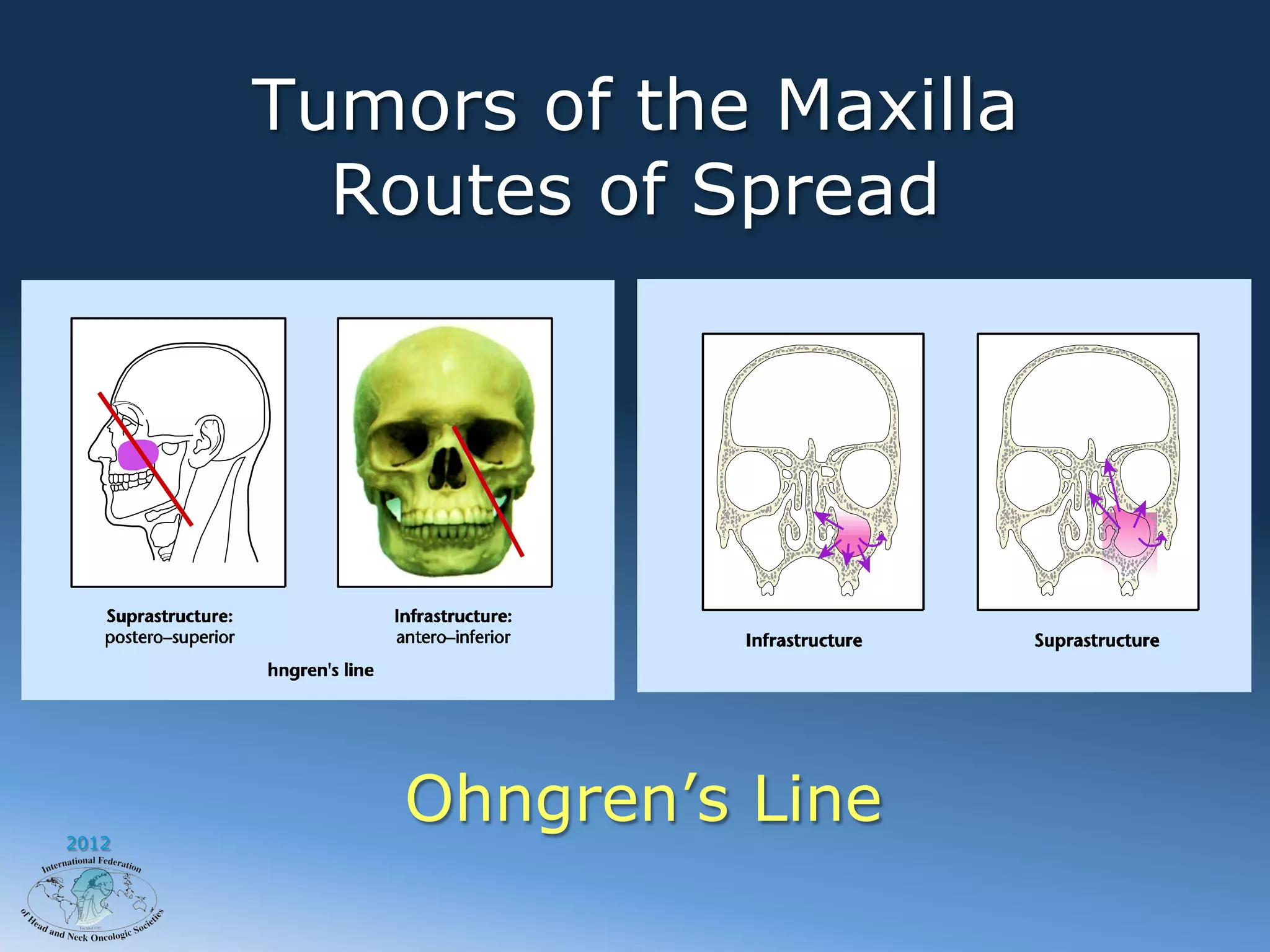 Skull base surgery by J. Shah | PDF