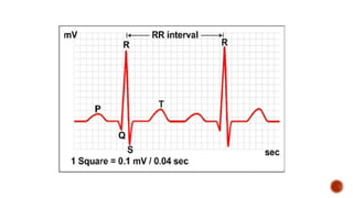 Understanding Sympathetic Skin Response (SSR) and RR Interval: A ...