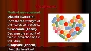 VENTRICULAR SEPTAL DEFECT by sherif ahmed | PPTX