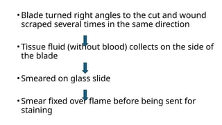 Slit skin smear- clinical competency.pptx