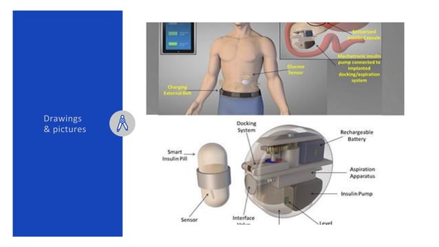 Artificial pancreas | PDF