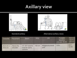 Superior Shoulder Suspensory Complex injuries (SSSC) | PPTX