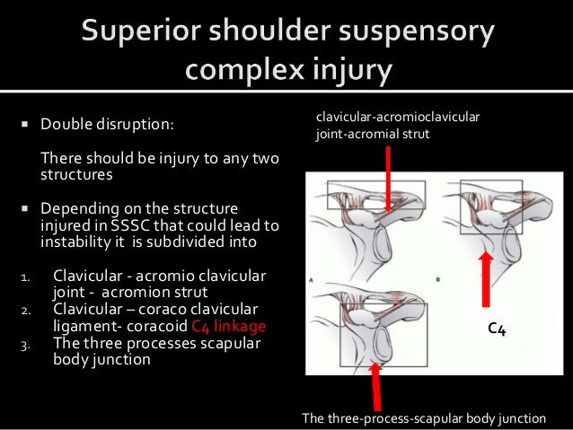 Superior Shoulder Suspensory Complex Injuries Sssc