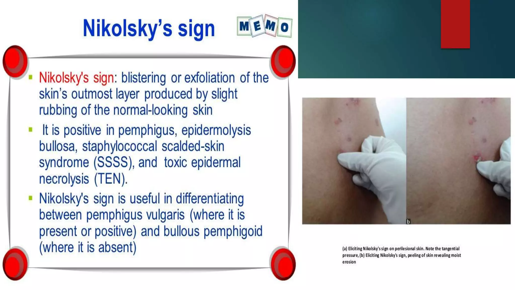 skin and soft tissue infection paediatric | PPTX