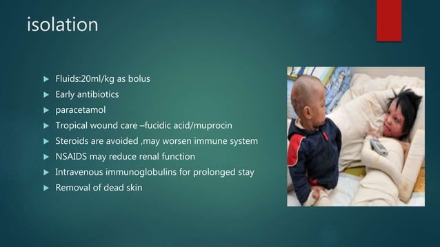 skin and soft tissue infection paediatric | PPTX
