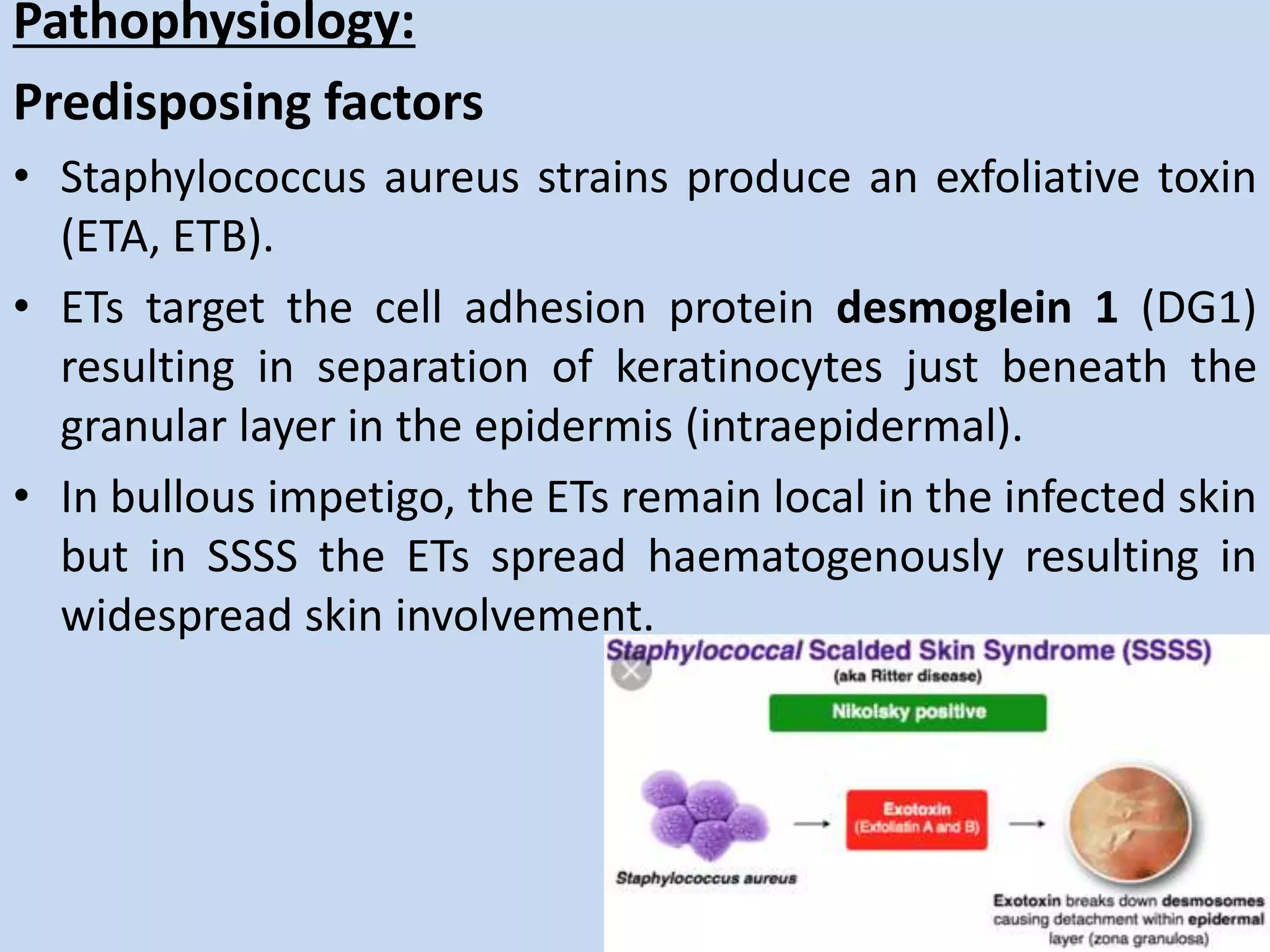 Staphylococcal Scalded Skin Syndrome Made Very Easy | PPTX