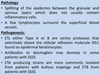 Staph Scalded Skin Syndrome Histology
