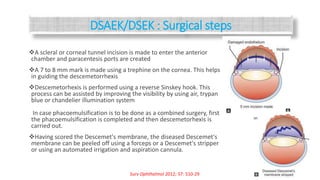 LAMELLAR KERATOPLASTY | PPTX