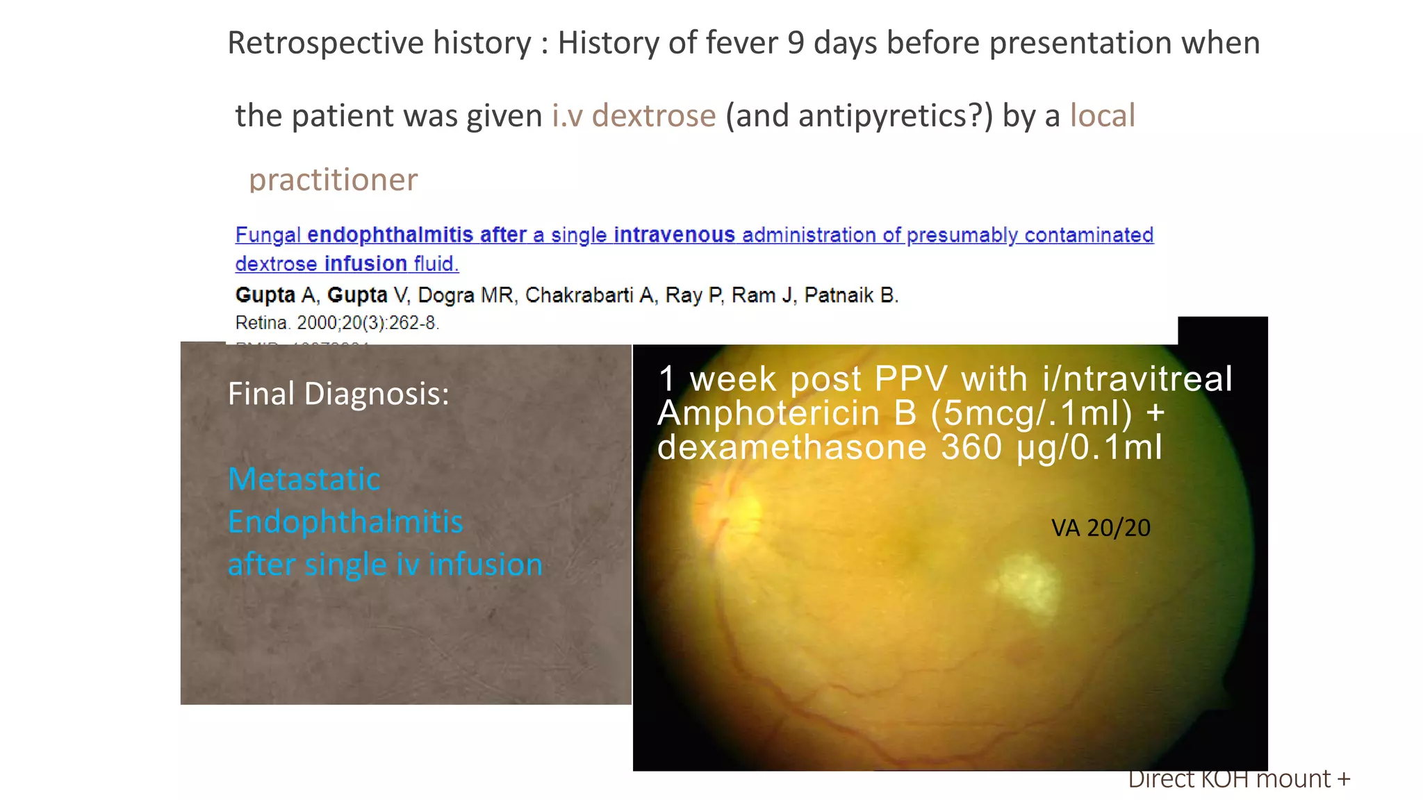 Uveitis: Workup and Management | PPTX | Eye and Vision Conditions ...