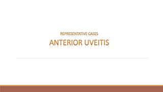 Uveitis: Workup and Management | PPTX