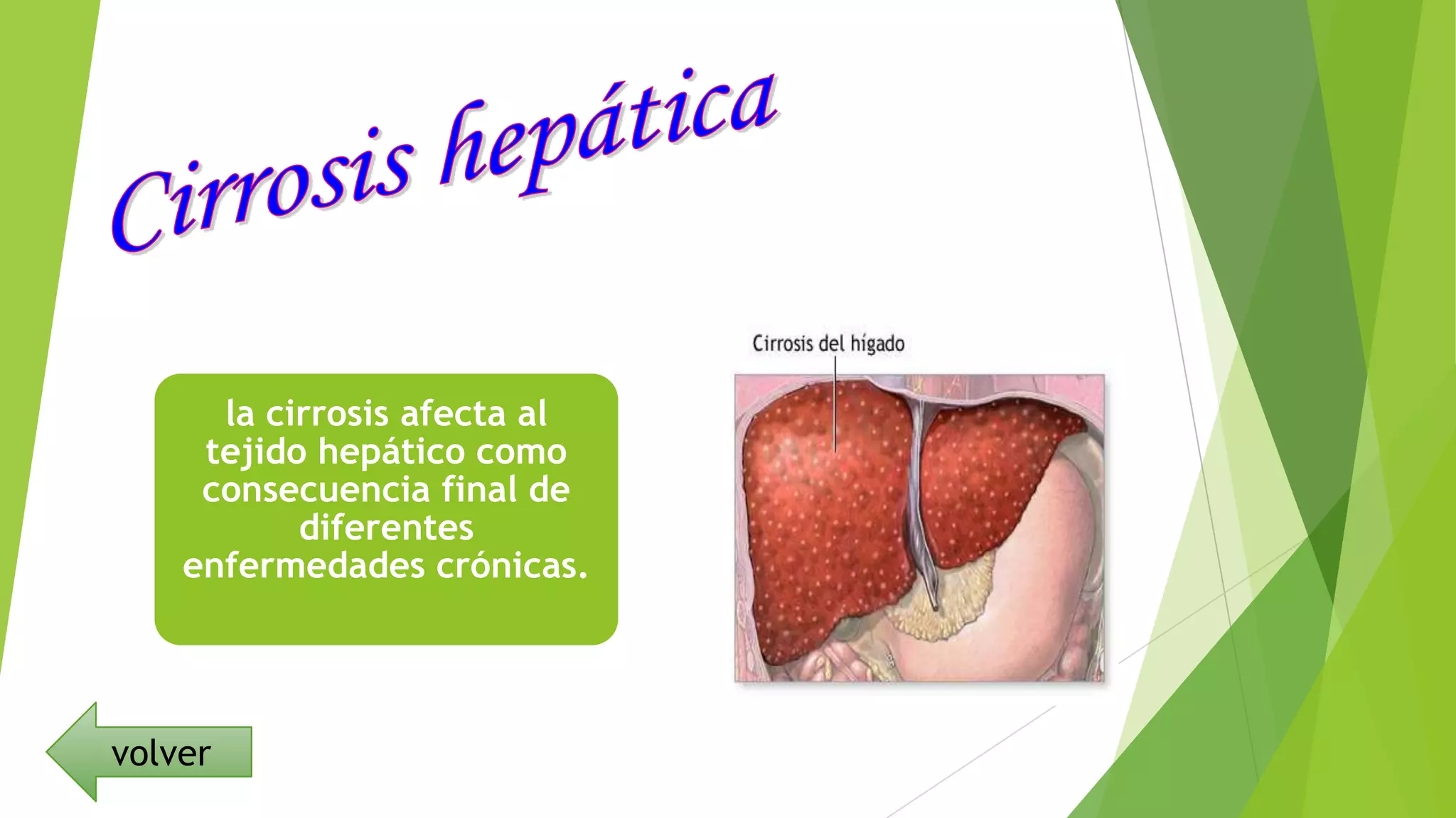 cirrosis hepatica | PPT