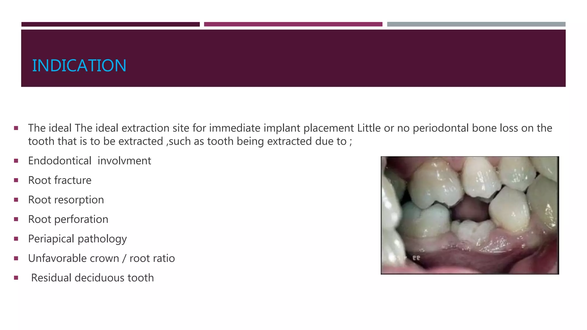 Prosthetic management of implant placed with socket-shield technique | PPTX