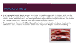 Prosthetic management of implant placed with socket-shield technique ...